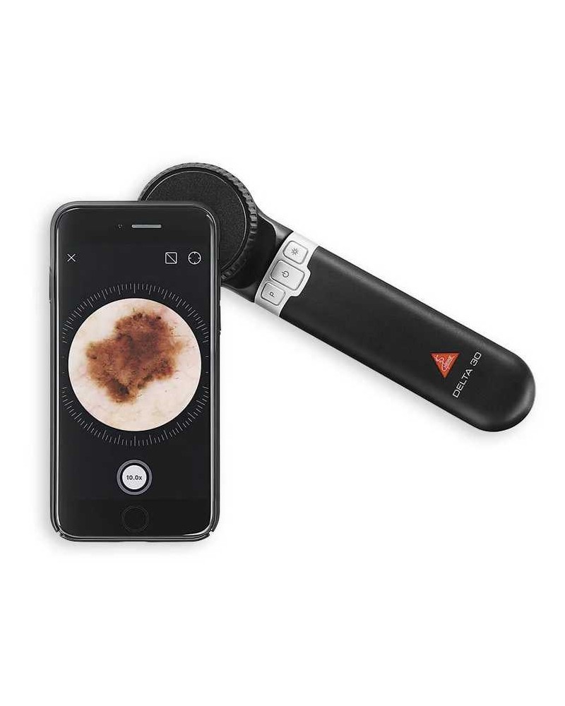 HEINE DELTA 30 Dermatoscope with table charging station